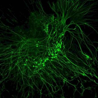 Showcase | School of Biomedical Sciences - UNSW Sydney