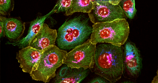 Lock Group: Cancer Systems Microscopy Lab