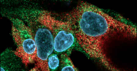 Electron Microscopy Research Group | School of Clinical Medicine - UNSW ...