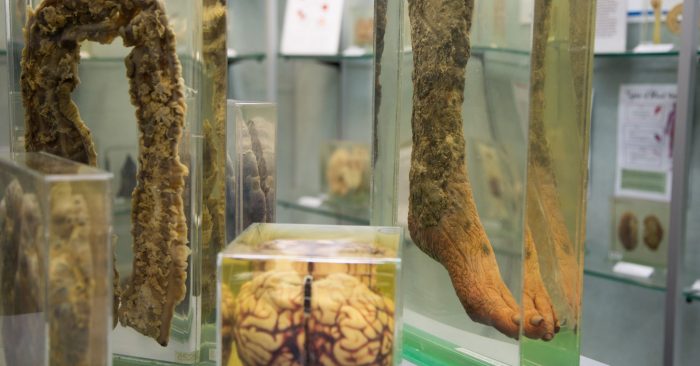 Preservation service | Museum of Human Disease - UNSW Sydney