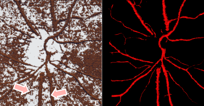 Optical Imaging and Visualisation | School of Optometry & Vision ...