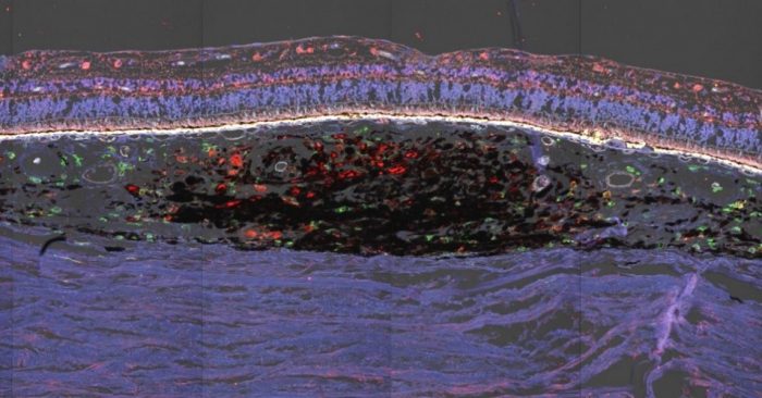 Ocular Pathology Research Group