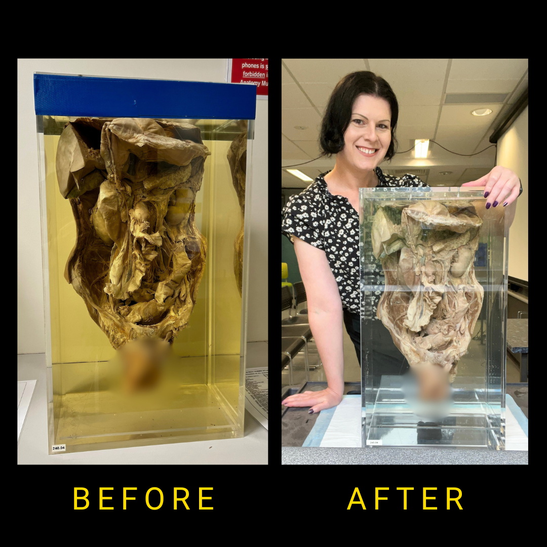 Preservation service | Museum of Human Disease - UNSW Sydney